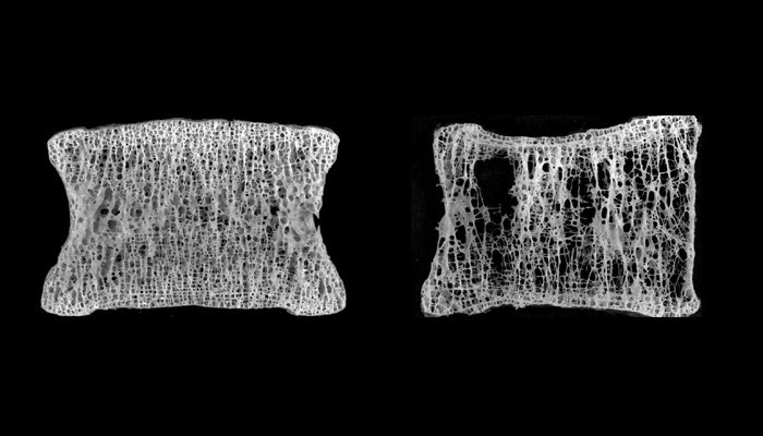 Making Old Bones New Again – Every Day Matters