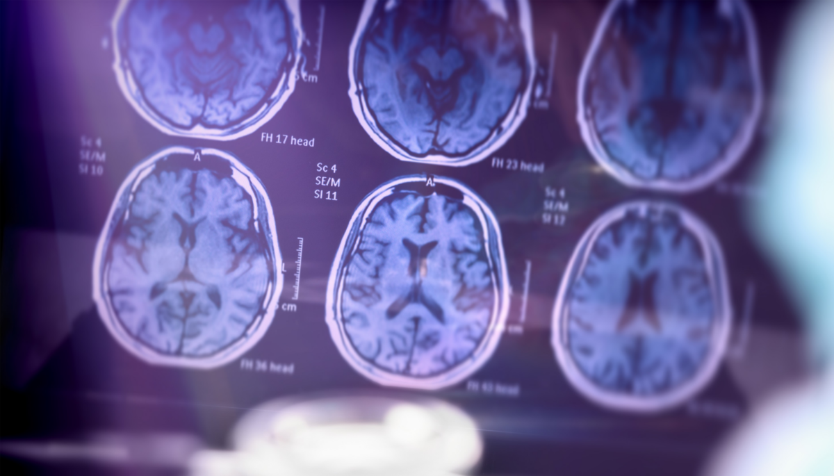 Improving Biomedical Imaging With AI – Every Day Matters